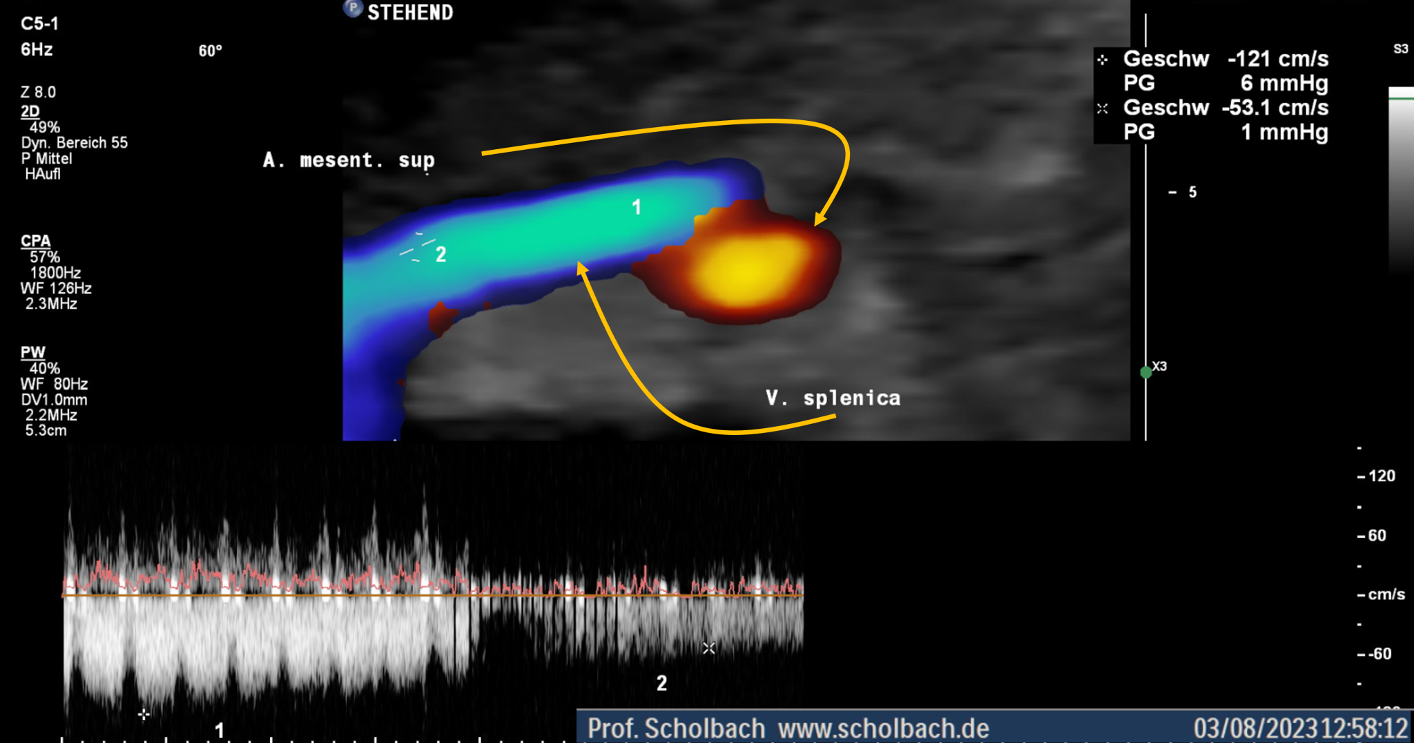 Posture dependent left flank / thoracic / lumbar pain – a new ...